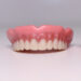 Buy Upper Denture Online - Easy Dentures